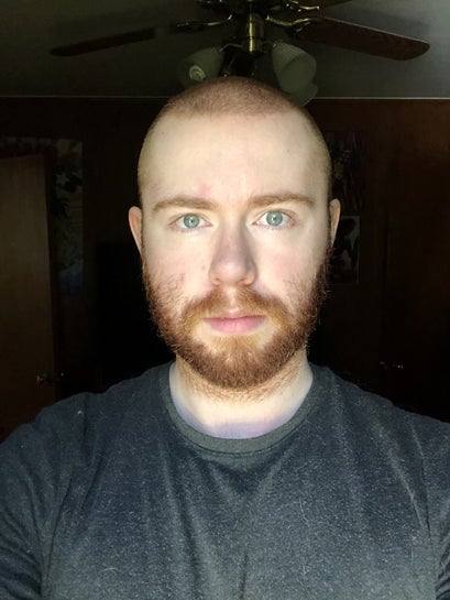 one eye slightly closed