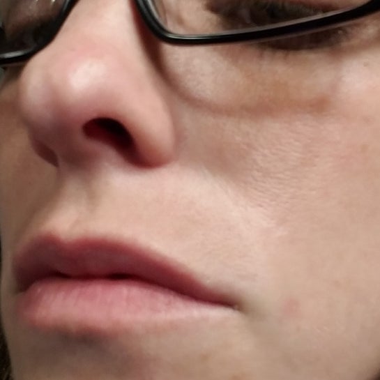 nose tip indentation