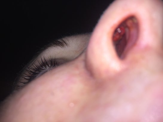 inside a normal nostril