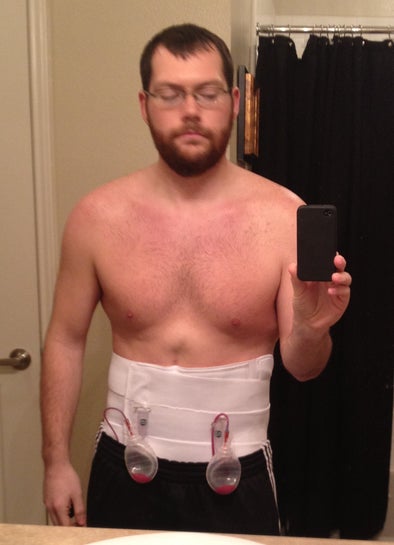 Xiphoid Process Protrusion Sternum: Anatomy And Labeled Diagram