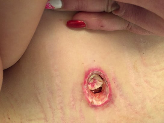 can your belly button open