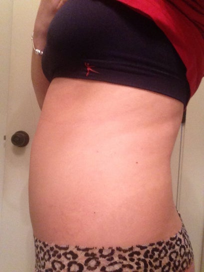 frowning belly button fix