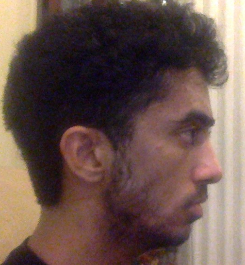 longer lower third face