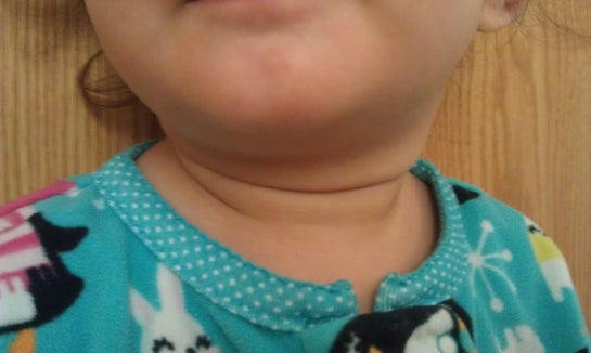 are neck rolls normal