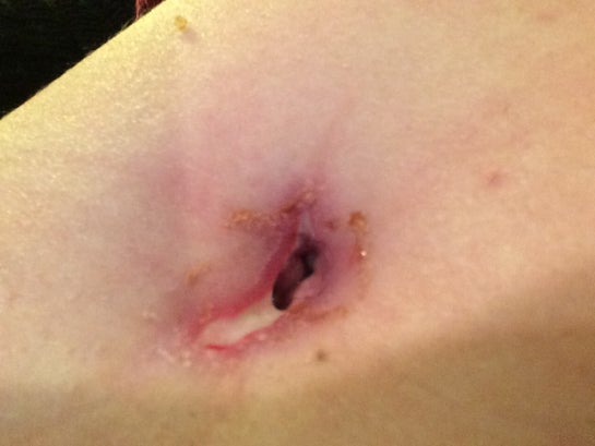 can your belly button open