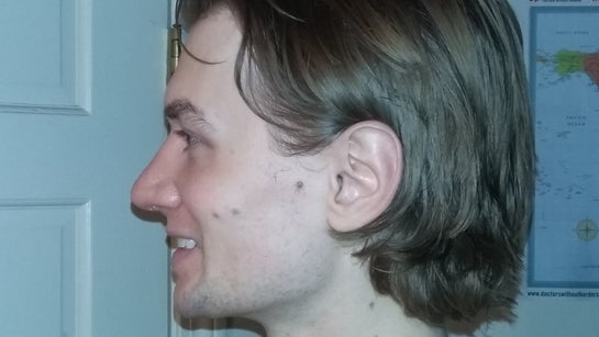 longer lower third face