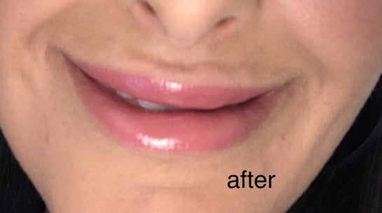 How To Fix Crooked Lips | Lipstutorial.org