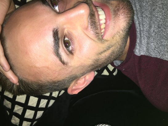 Carter Vein In Forehead