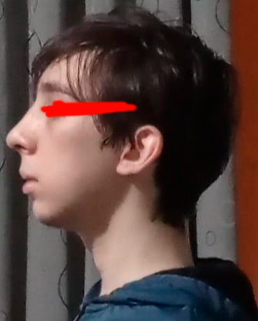 Curved Forehead