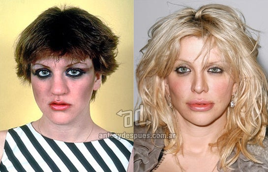 courtney love nose job before and after