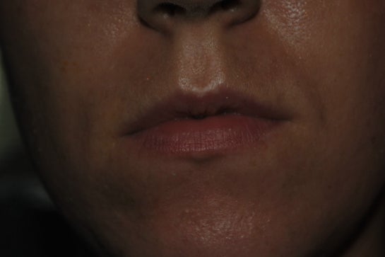 How To Correct Droopy Lips | Lipstutorial.org