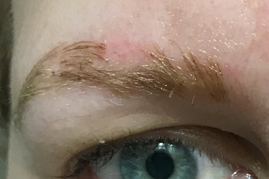 Eyebrow Tattoo Flaking