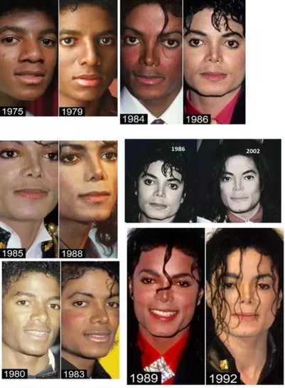 michael jackson noses