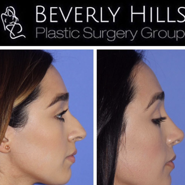 Beverly Hills Plastic Surgery Group - Beverly Hills, California - Realself