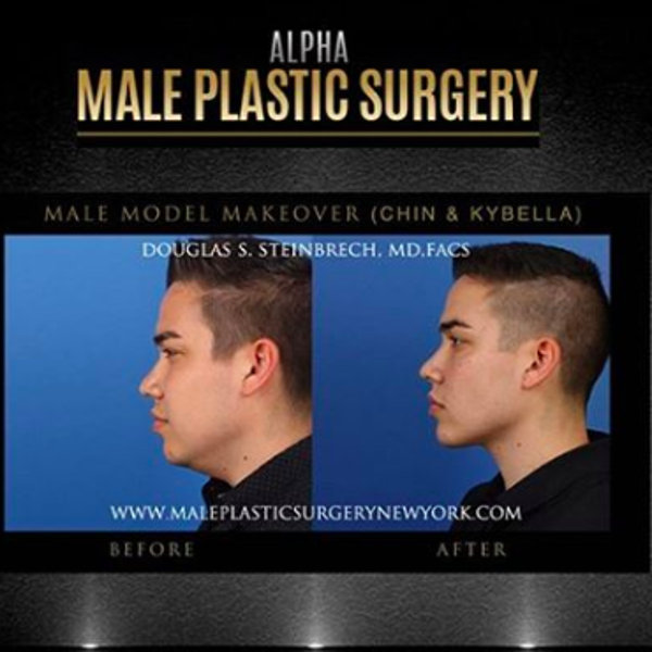 Male Plastic Surgery - Beverly Hills - Los Angeles - Beverly Hills ...