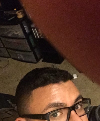 I'm 22 and I have frown marks. What should I do? (Photo) Doctor Answers ...