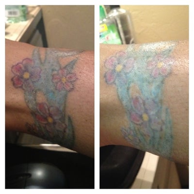 Westlake Dermatology Tattoos Best Tattoo & Piercing Near Me In