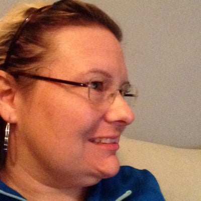 Deep labiomental crease and golf ball chin when smiling. (Photo) Doctor ...