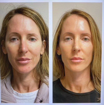 is morpheus worth it