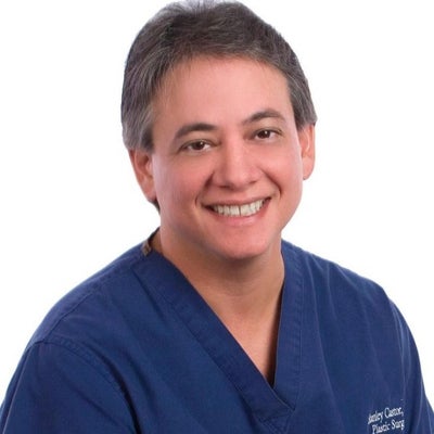 Stanley Castor, MD, Board Certified Plastic Surgeon | Real Patient ...