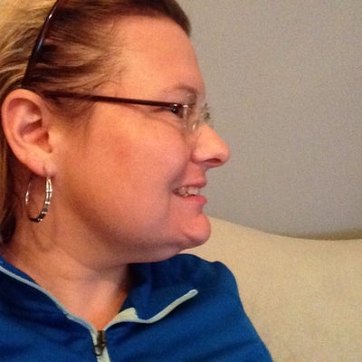 Deep labiomental crease and golf ball chin when smiling. (Photo) Doctor ...