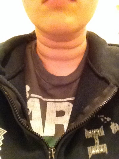 Why do I have rolls of skin on my neck when I've never been overweight ...