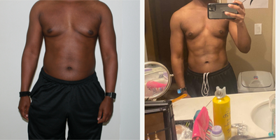 Abdominal Etching Before & After Pictures - RealSelf