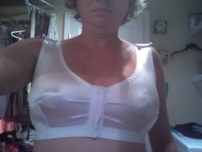 34b breast reduction