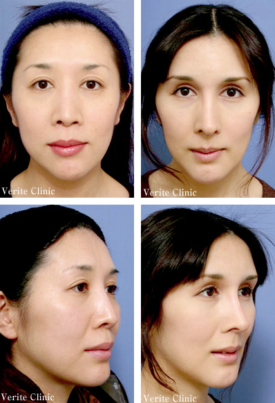 Confirming the Possibility of This Race-change of Surgery? (photo ...