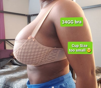extra large breast augmentation