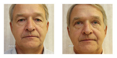 nadia plastic surgery