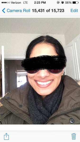 Want V (tear/tapered shaped) defined jaw + chin projection. Sliding ...