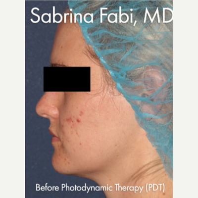 Photodynamic Light Therapy | Shelly Lighting