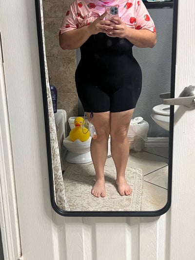 Uneven hips after bbl - will this change? - Brazilian Butt Lift forum