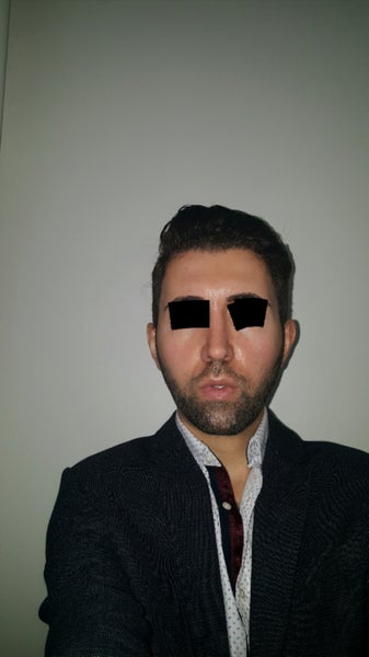 What will get me a defined angular face, and masculine sharp jaw line ...