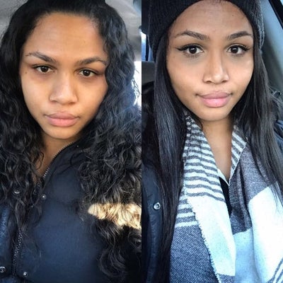 Has anyone gotten FFS through Bryan Rolfes at Omni? (Minnesota) : r ...