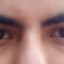 Why does one of my eyes look smaller than the other one in photos?...