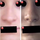 Open roof: What's the best surgical method to correct it? Doctor ...