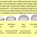 345cc, Natrelle, silicone, round, moderate profile implant. 5’6 1...