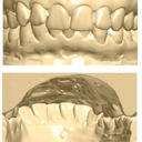 7mm overjet, about 4-5 cm overbite...Braces? Dentist Answers, Tips
