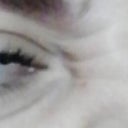 Can Botox Migrate in Human Faces? Doctor Answers, Tips