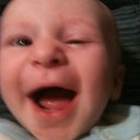 My 7mnths Old Baby Having One Eye Bigger Than the Other,is There Any ...