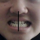 How Do I Fix Off-centerd Teeth? (photo) Doctor Answers, Tips