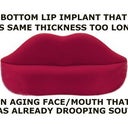 Surgisil Needs to Revise the Shape of the PermaLip Implant - Tulsa ...