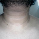 How do I get rid of deep creases/lines around my neck and collarbones ...