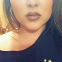 Heavy lower cheeks and getting wider? (Photos) Doctor Answers, Tips