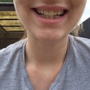 How Do I Fix Off-centerd Teeth? (photo) Doctor Answers, Tips