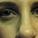 Empty Eye Socket Real