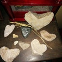 Excitedly Anticipating Posterior... - Review - RealSelf