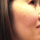 What can I do to fix my leathery looking skin? (Photo) Doctor Answers, Tips